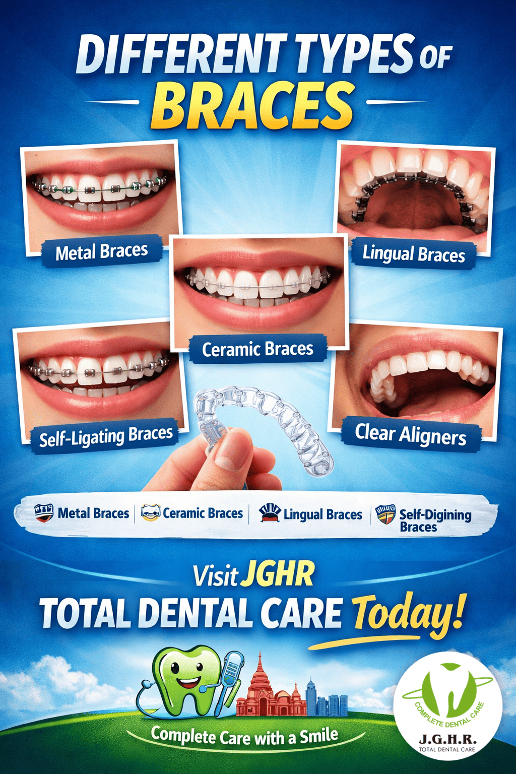 Teeth Braces in Chennai – A Complete & Simple Guide for Everyone - JGHR ...